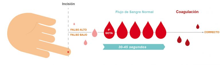 Toma de muestra capilar - BIOCORP EUROPA S.L.